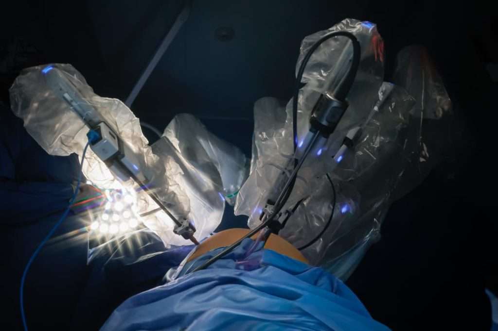 Inicia ISSSTE Plan de Cirugía Robótica con dos exitosas intervenciones ...